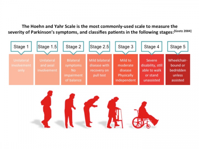 Parkinson's......Why Wait? - Connect Neuro Physiotherapy